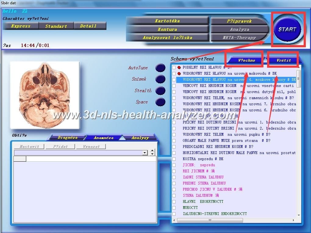 3d Nls Training Manual - MAIKONG 3d Nls Health Analyzer | 3d Nls Health ...