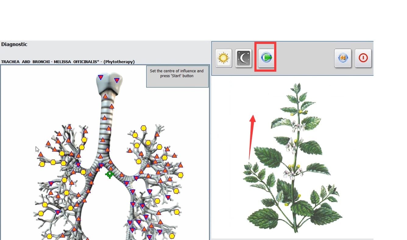 Hunter Nls What It How Work Why It And Who Need? - MAIKONG 3d Nls ...