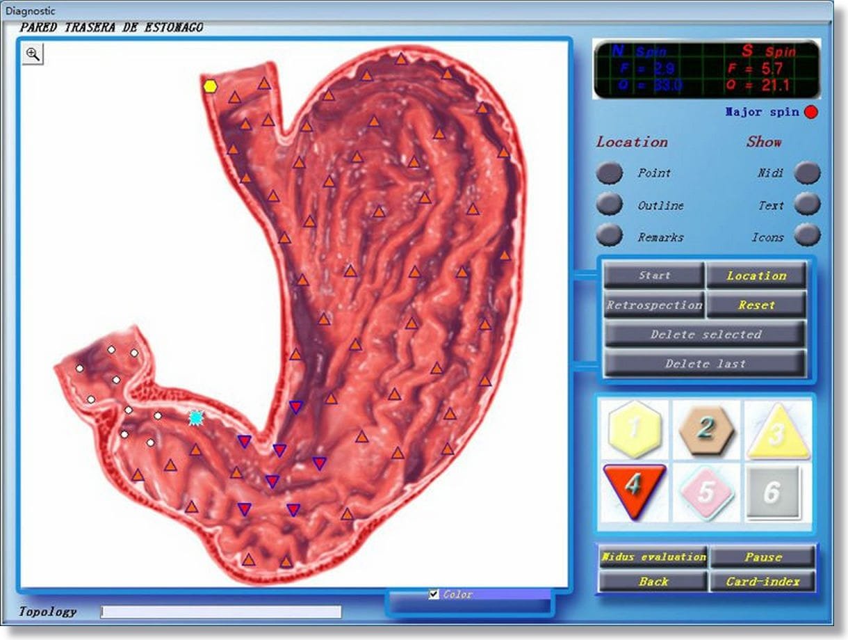 Diacom NLS Training: Everything You Need To Know - MAIKONG 3d Nls ...